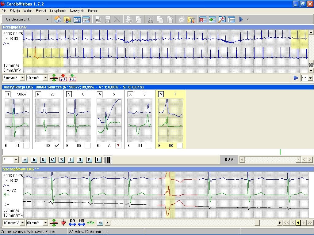 Witryna BIOMEXIM Sp. z o.o. - 24-godzinny holter MEDITECH CardioMera